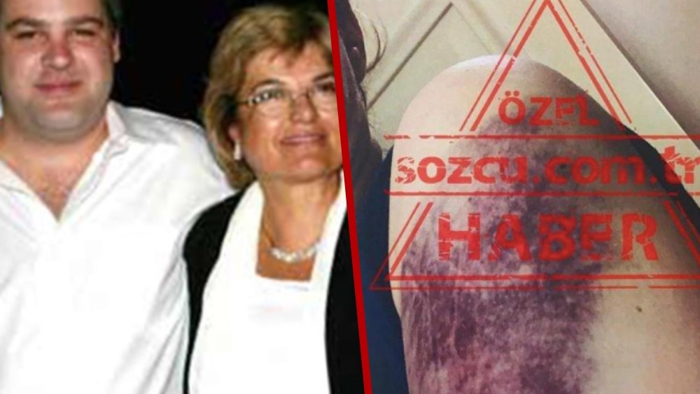 Tansu Çiller'in oğlu Mert Çiller'e 10 yıl hapis talebi: Kaburgaları ...